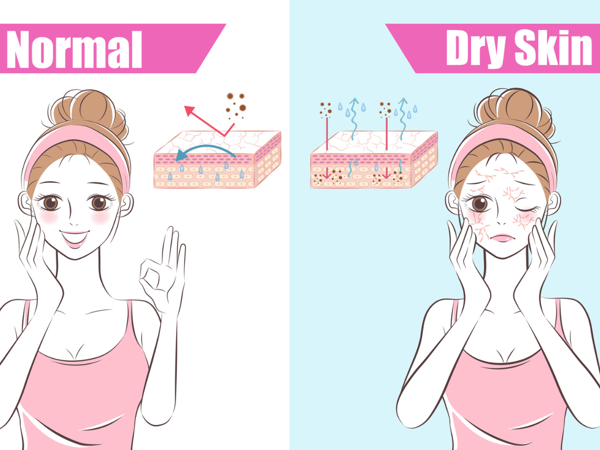 Why Is My Skin So Dry Even When I Moisturize? | Elite Selects